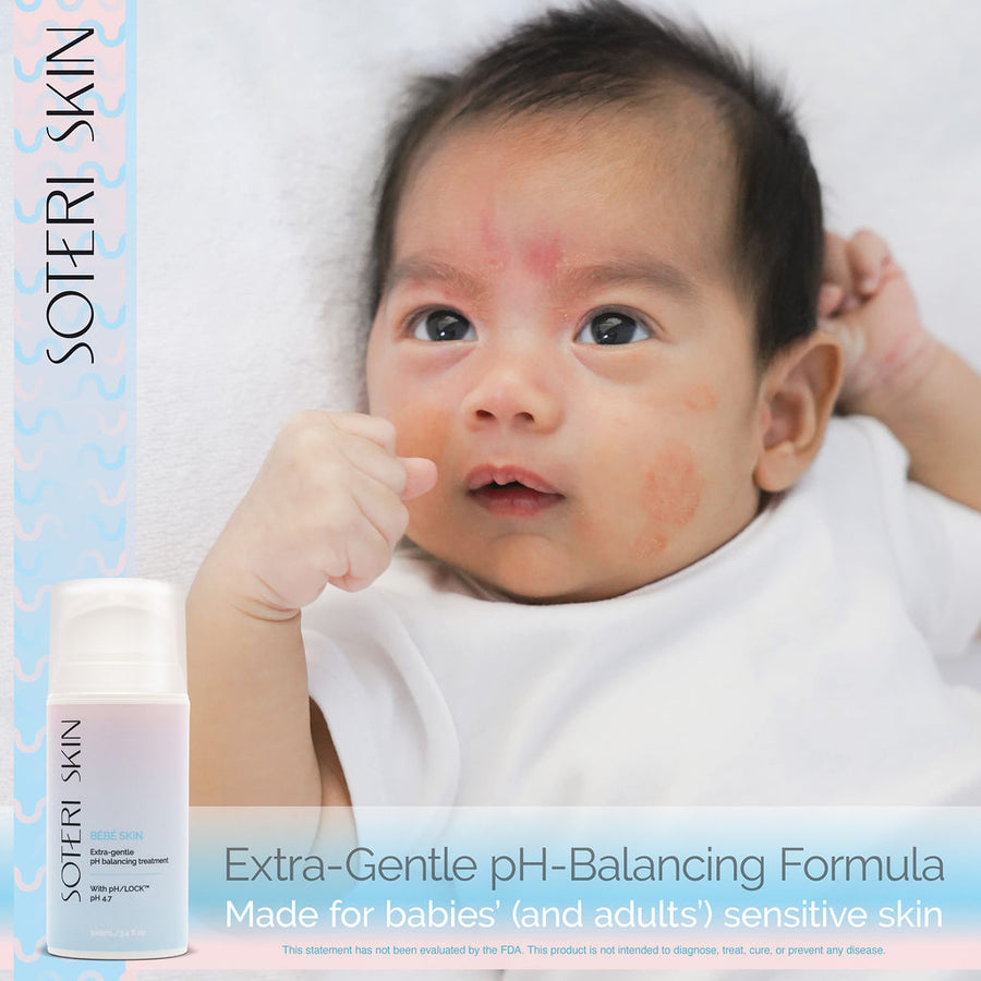 BÉBÉ SKIN: Gentle Baby Eczema Cream